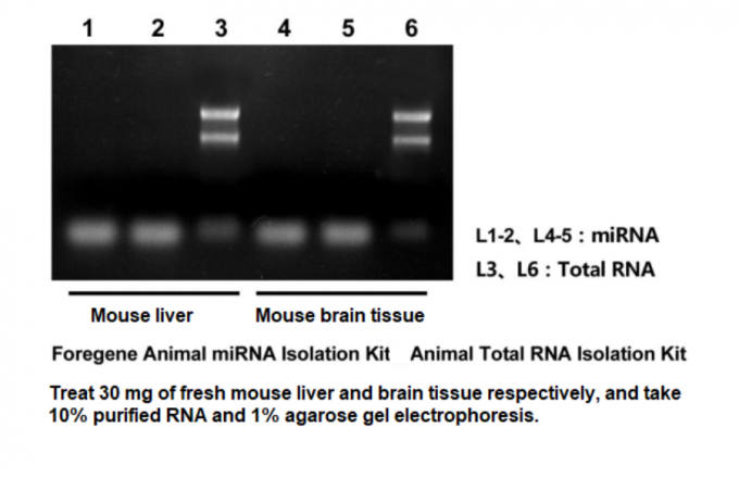 Room Temperature Operation Animal MiRNA Isolation Kits Fast High RNA Yield