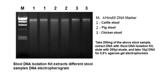 Fast Room Temperature Operation Stool DNA Isolation Kits For Genomic ...